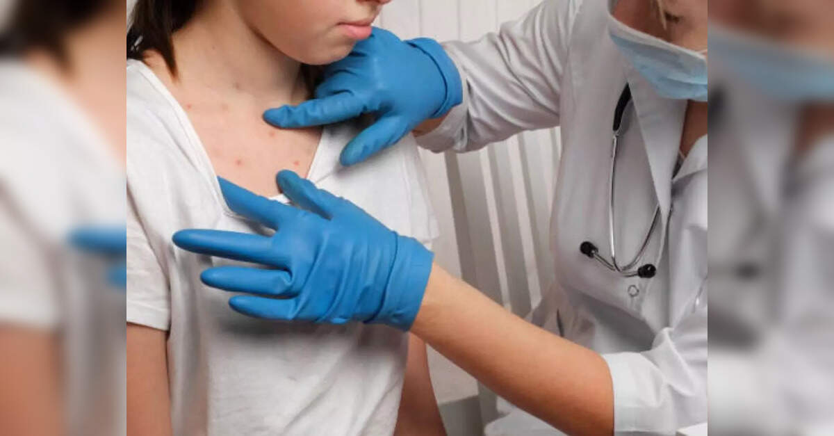 Measles is one of the deadliest and most contagious infectious diseases - and one of the most ...