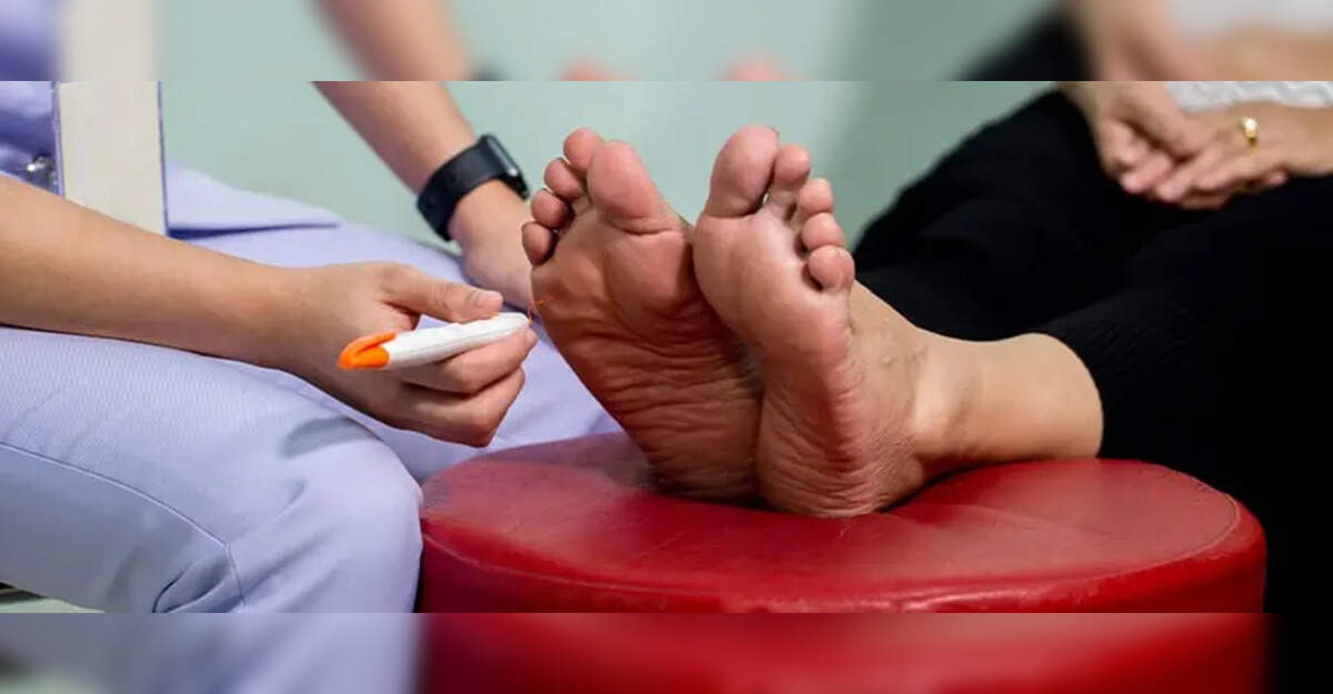 Record-Breaking Peripheral Neuropathy Screenings by CORONA in ...