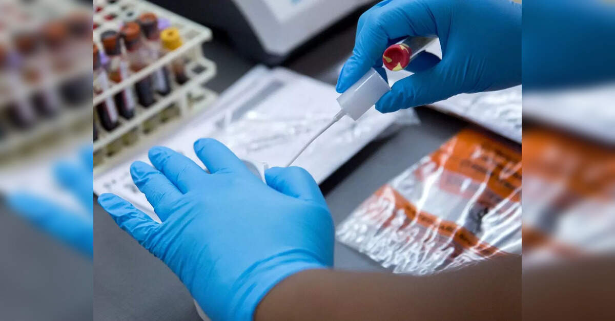 Post-pandemic Recovery: Labcorp beats Q2 profit and revenue estimates ...