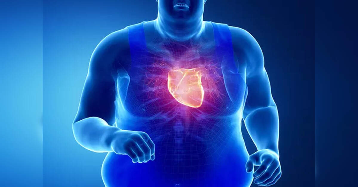 Novo Nordisk: EU regulator backs use of Novo's Wegovy for obesity ...