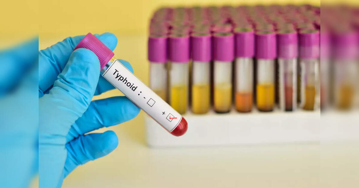 Significant surge in typhoid, other vector-borne disease claims during ...