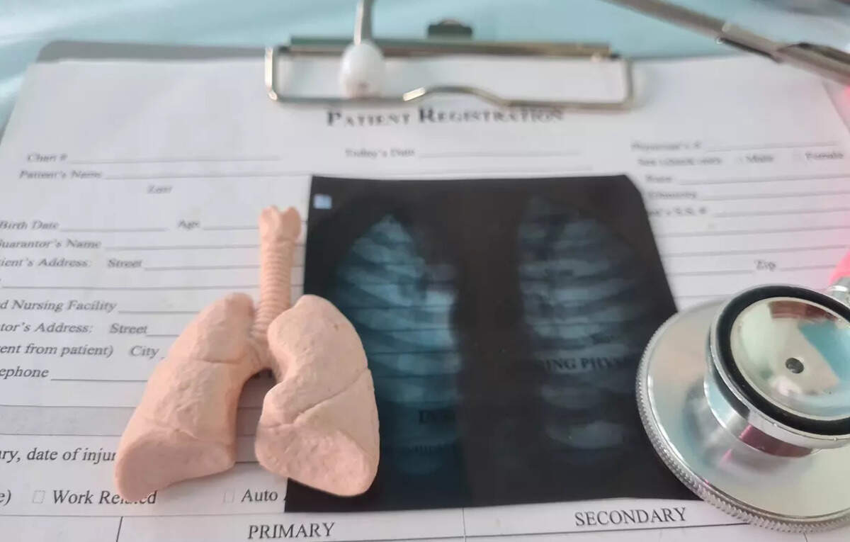 Anatomic lung resection linked to improved survival for early-stage ...