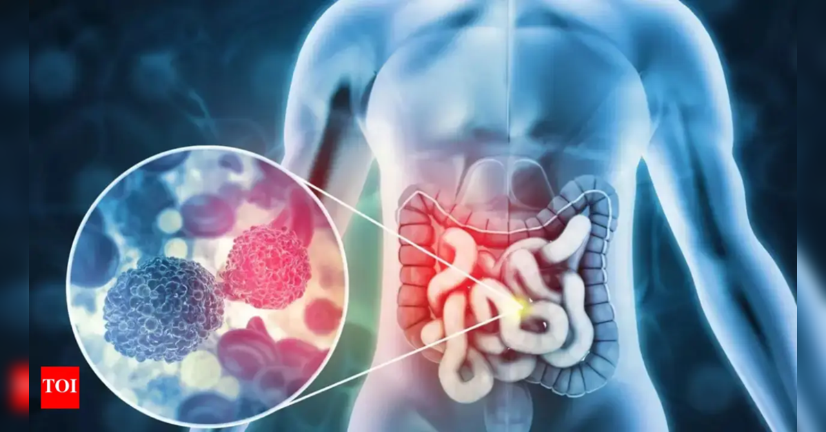 Childhood exposure to bacterial toxin can trigger Colorectal cancer ...