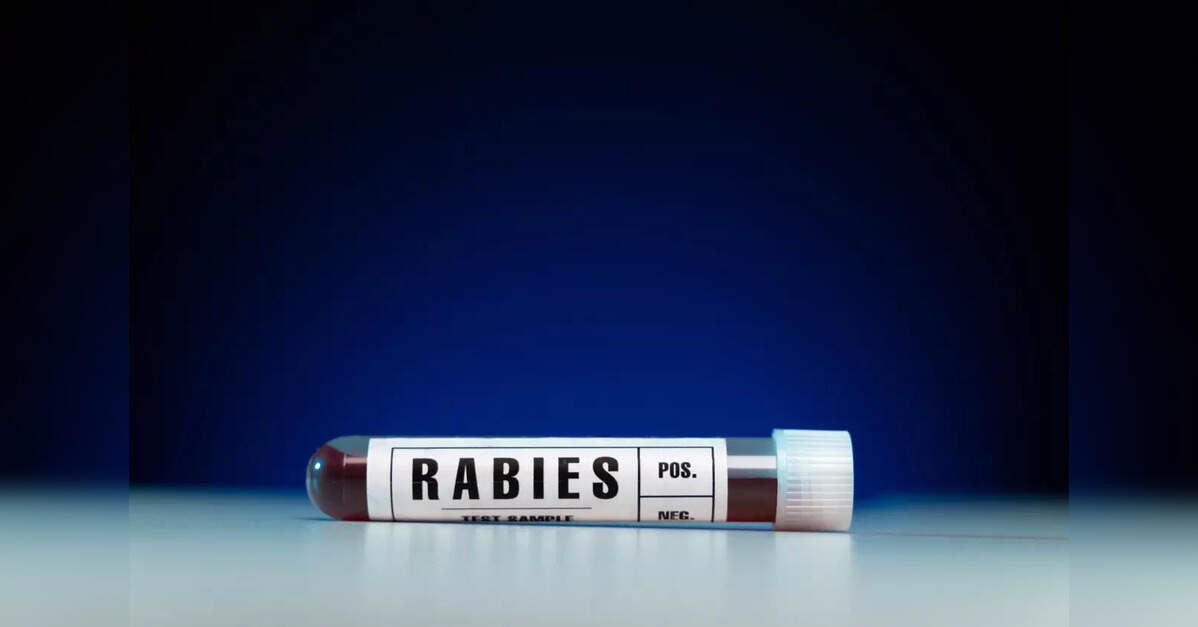 Rabies Immunoglobulin: Nationwide Survey Reveals Alarming RIG Shortage ...