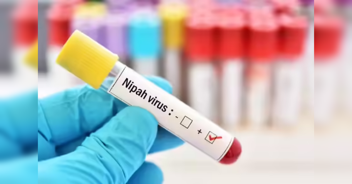 No Active Nipah Virus Found in West Bengal Bats; Past Exposure Detected ...