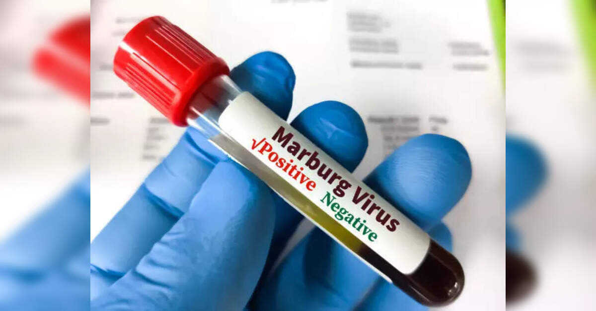 Ethiopia Ends Deadly Marburg Virus Outbreak That Claimed Nine Lives ...
