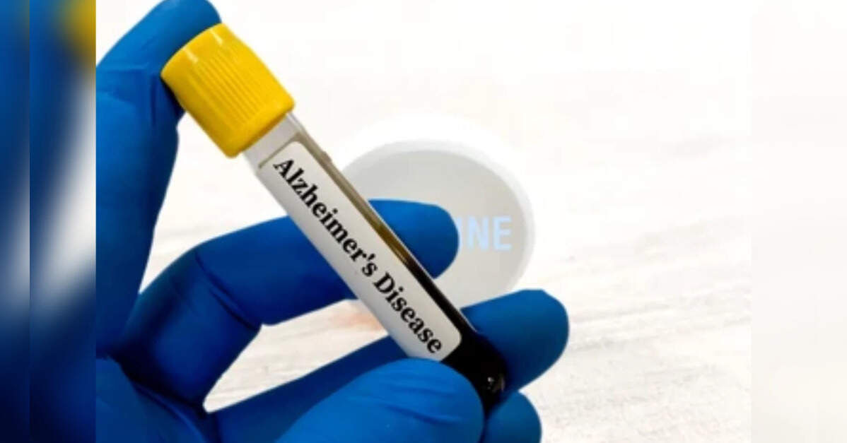 ALZpath Partners with Abbott for Breakthrough Alzheimer's Blood Test ...