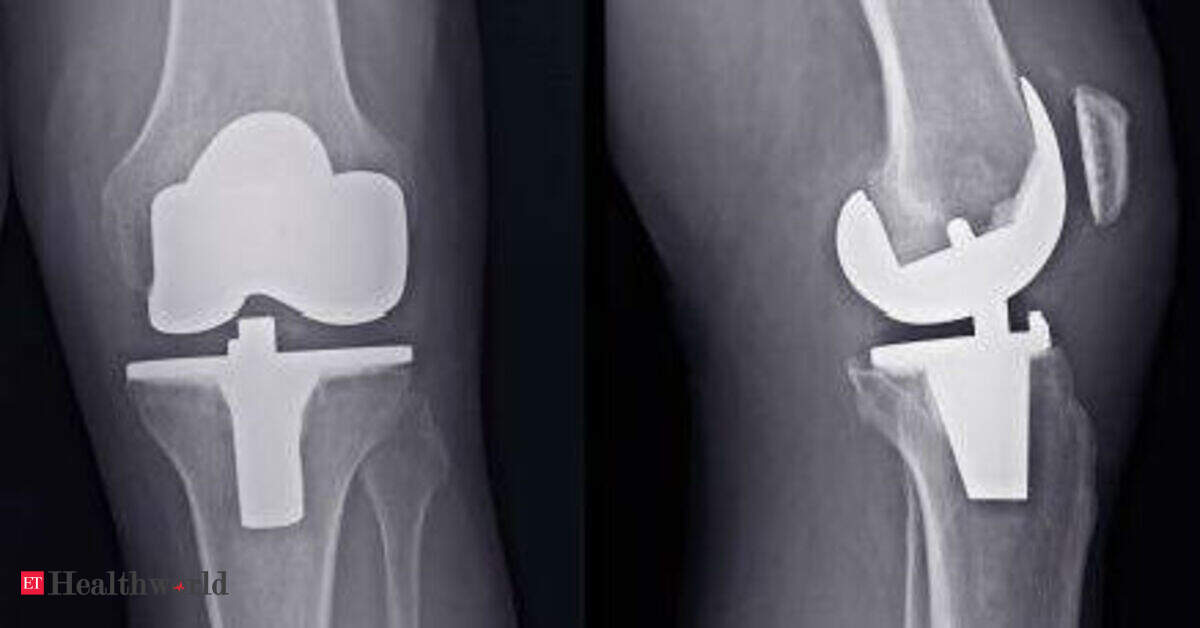 Natural bone implants may replace metal ones, Health News, ET HealthWorld