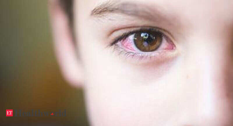 Air pollution major cause of eye infection:Doctors, Health News, ET ...