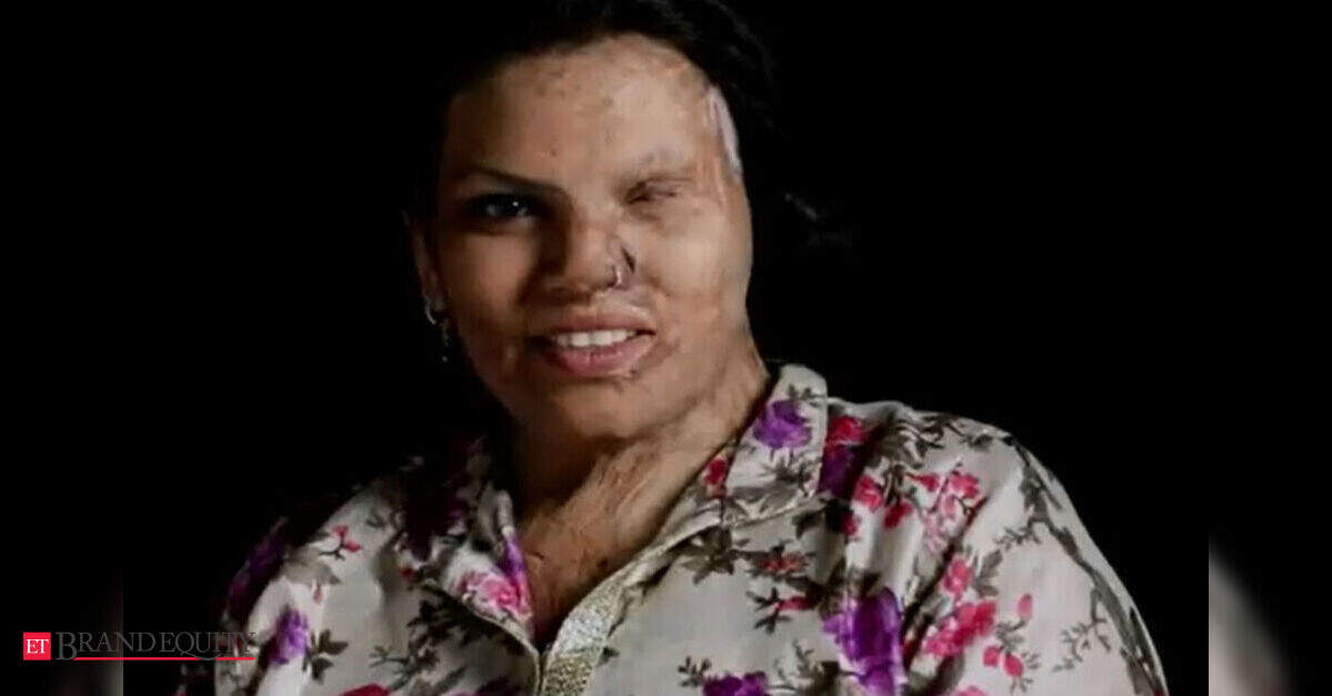 Would you hire acid-attack survivors?, ETBrandEquity