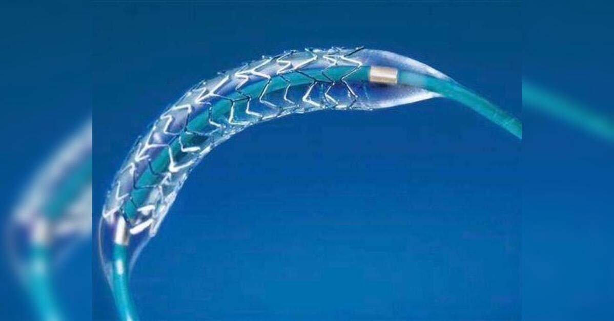 No shortage of stents in the country: NPPA, ETHealthworld