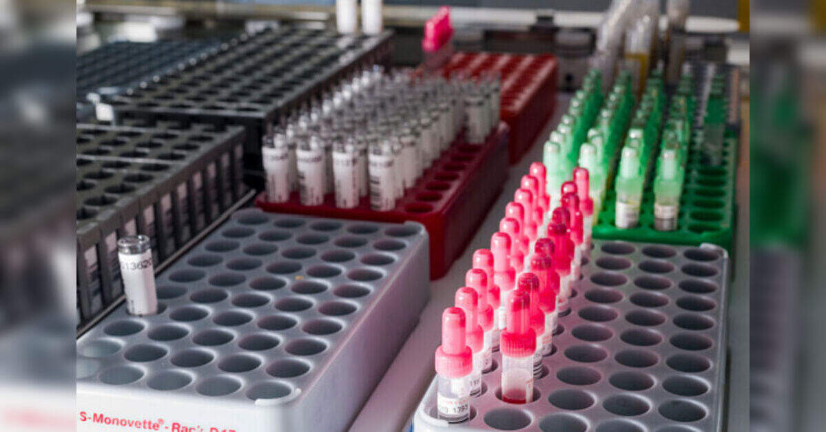 Pharma Testing Lab: NIPER to set up pharma products test lab in Baddi ...