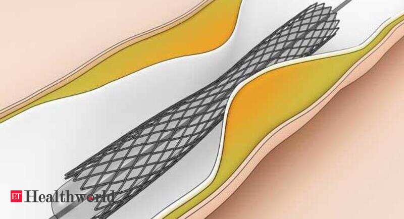 SMT bags Cardiac Stents & Catheters tender in Romania, Health News, ET ...