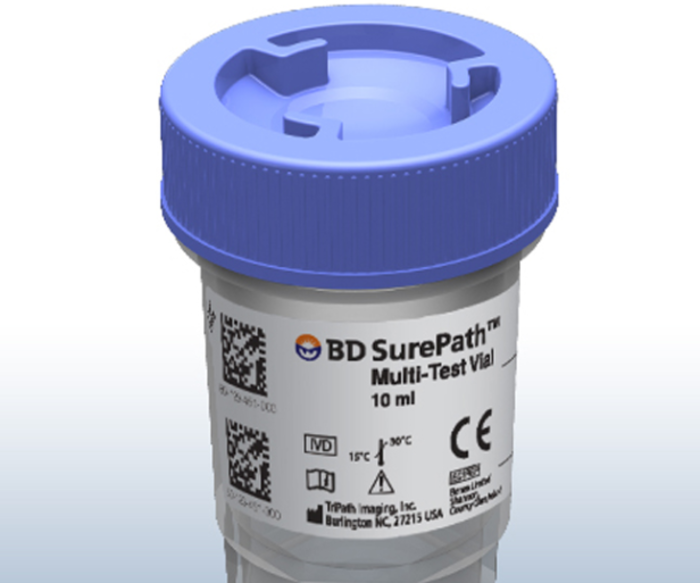 Cervical cancer: BD launches LBC technique for cervical cancer ...