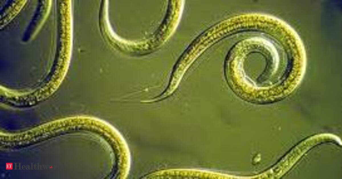 Doctors remove 14 roundworms from woman's bile duct, Health News, ET ...