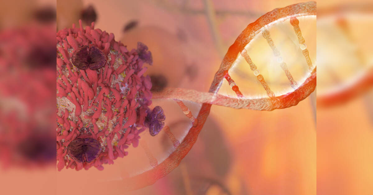 New subtype of prostate cancer discovered, ETHealthworld