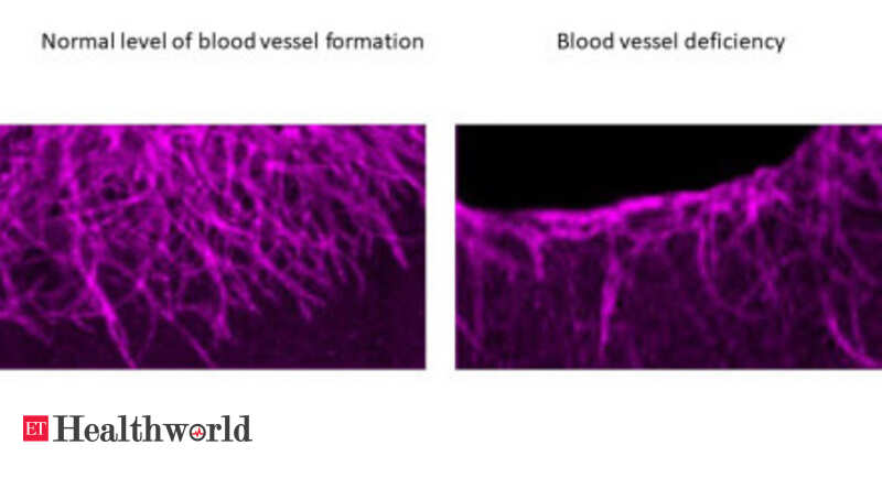 Mechanism for the formation of new blood vessels discovered, Health ...
