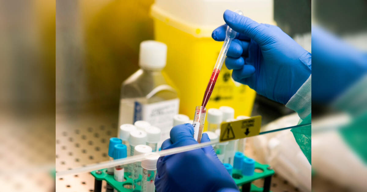 How to know the right type of serology test to understand immunity ...