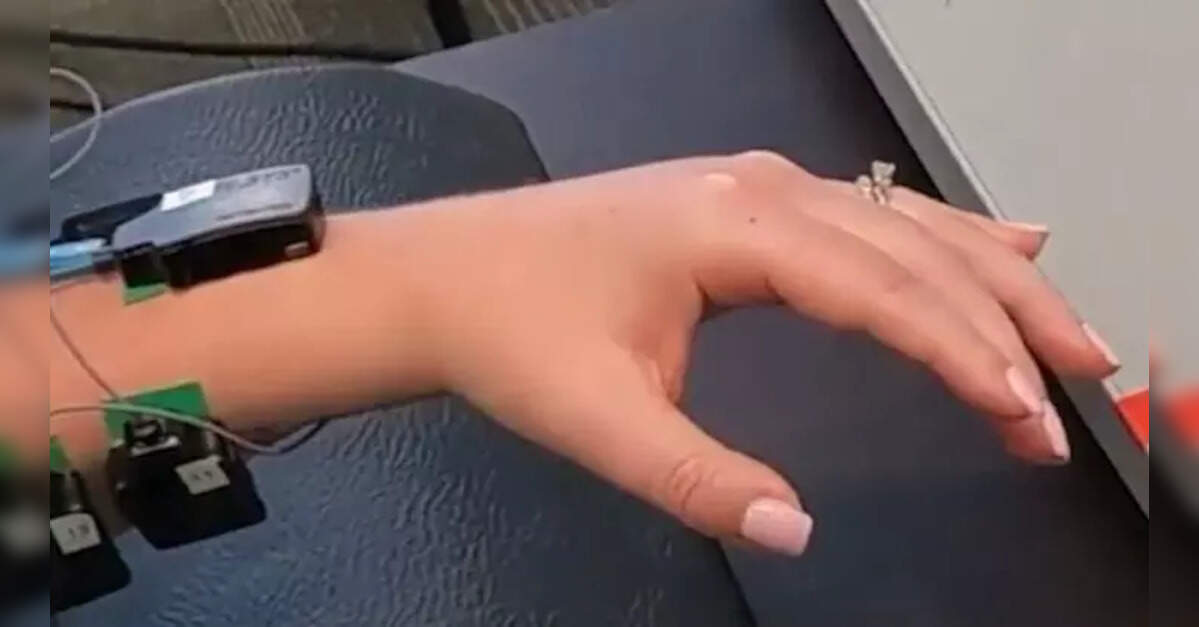 Spinal cord stimulation restores arm, hand mobility in stroke patients ...